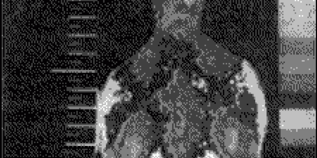 Infrared Thermography in the Personal Injury Practice: An Overview for ...