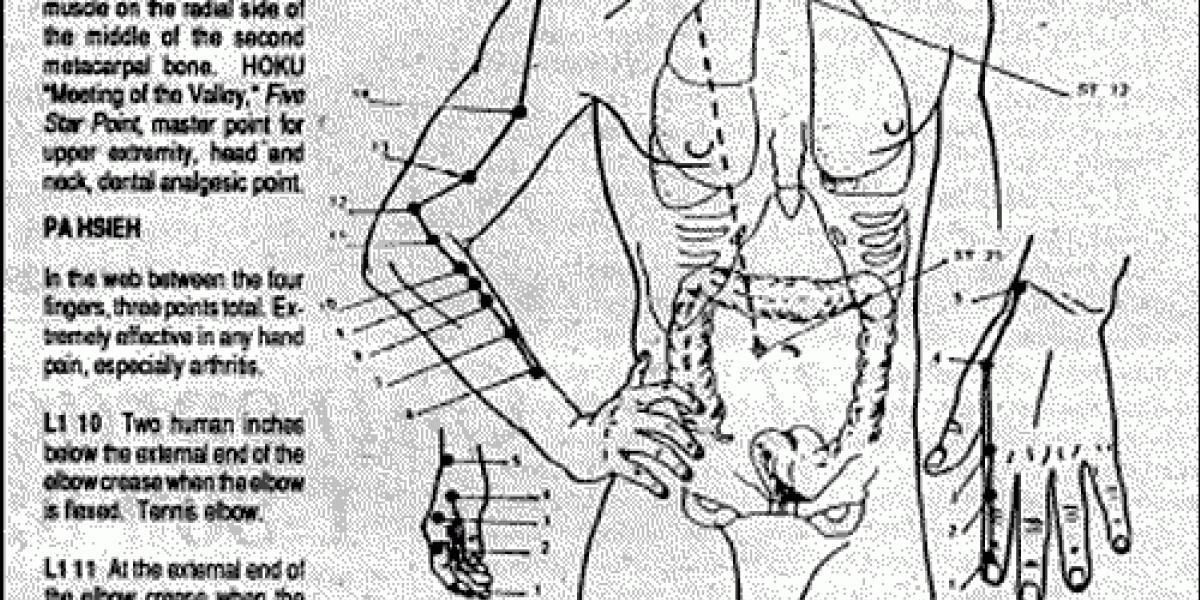 "The Most Important Notes of Acupuncture" | Dynamic Chiropractic