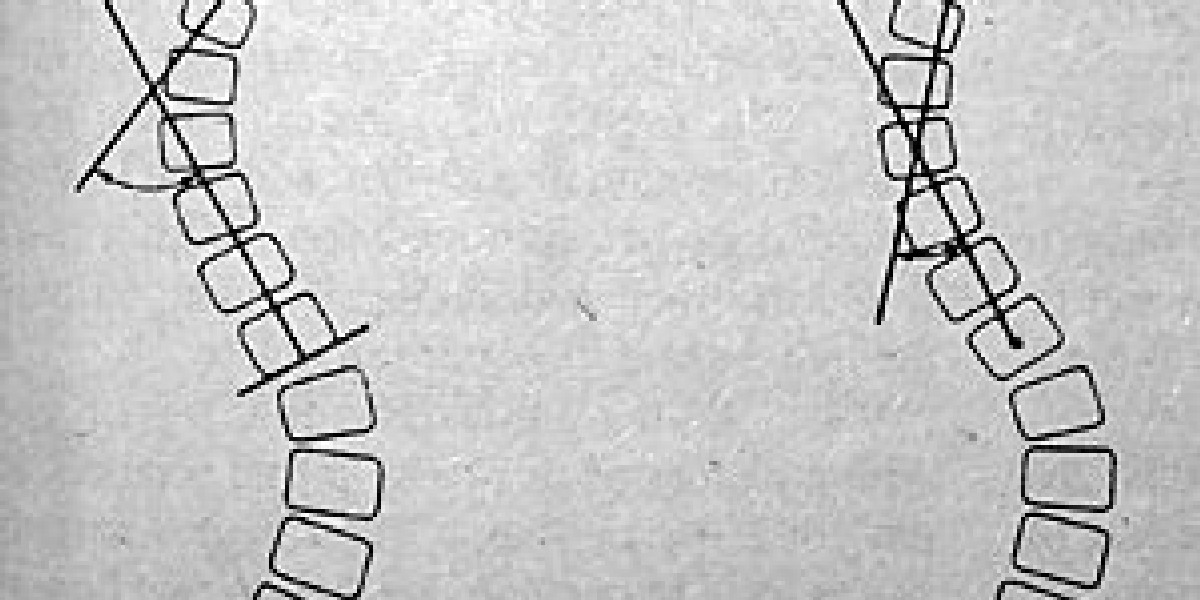 Radiologic Techniques for Evaluating Scoliosis | Dynamic Chiropractic