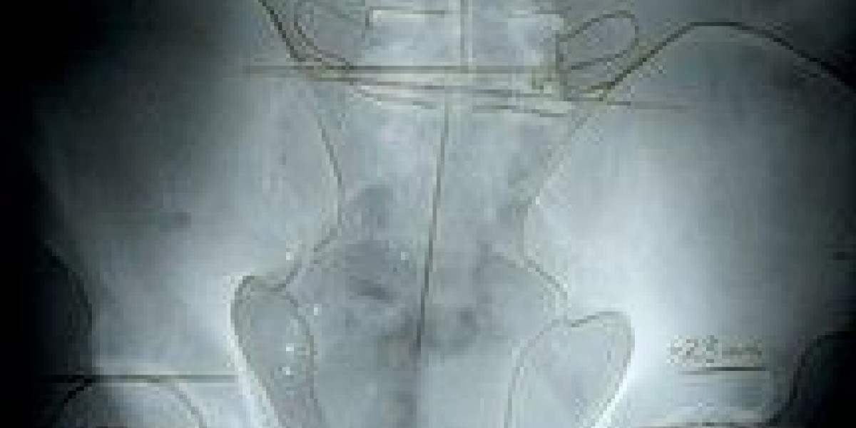 The Lowdown on Short Legs | Dynamic Chiropractic