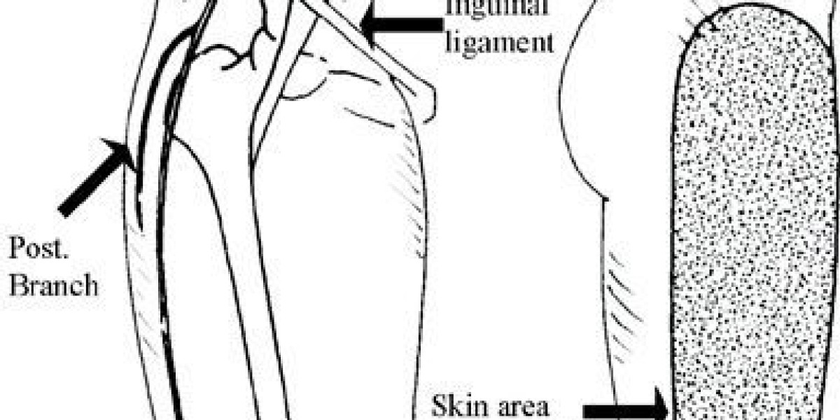 Lateral Femoral Cutaneous Nerve Entrapments | Dynamic Chiropractic
