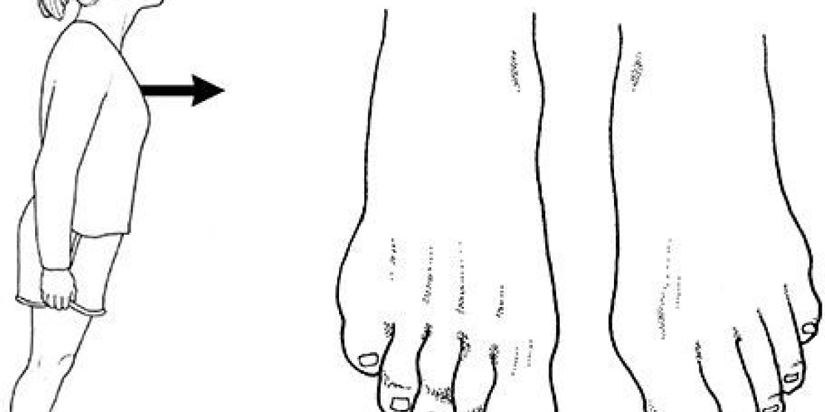 The Positive Wink Sign | Dynamic Chiropractic