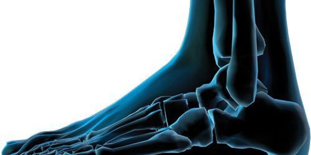 A Simple Exam Protocol to Assess Lower-Extremity Imbalance | Dynamic ...