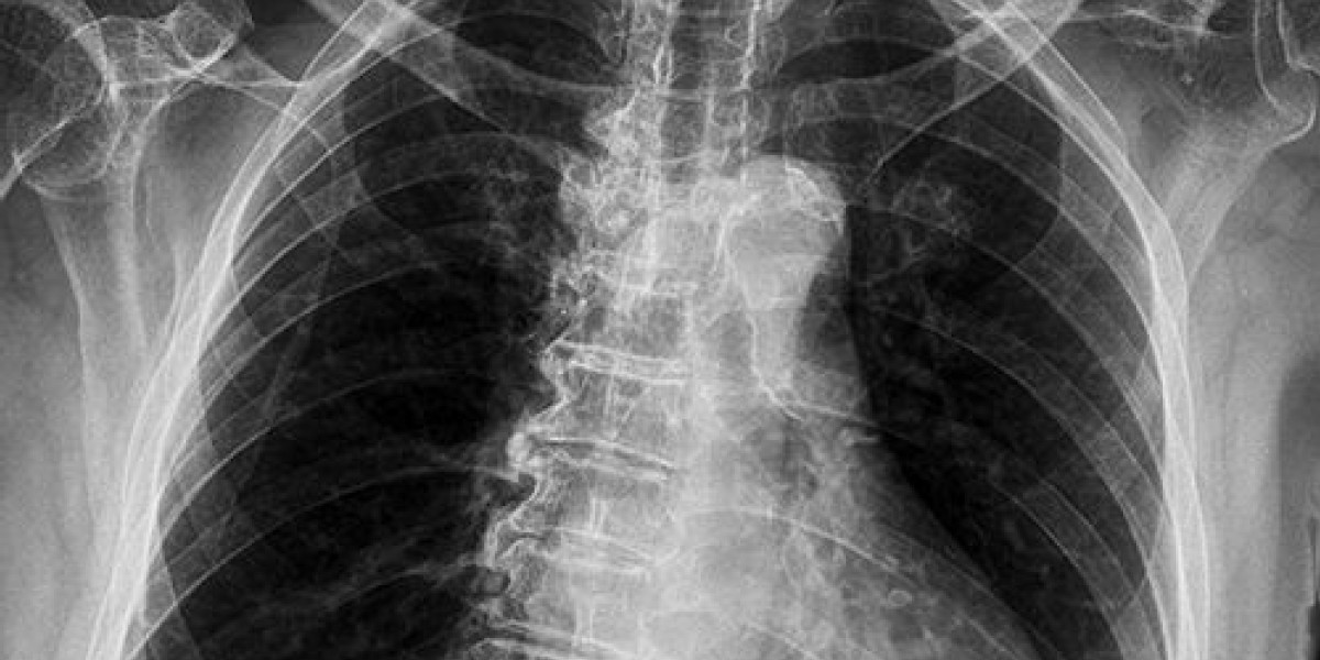 Lumbar Spine Manipulation and Water Diffusion in the Intervertebral ...