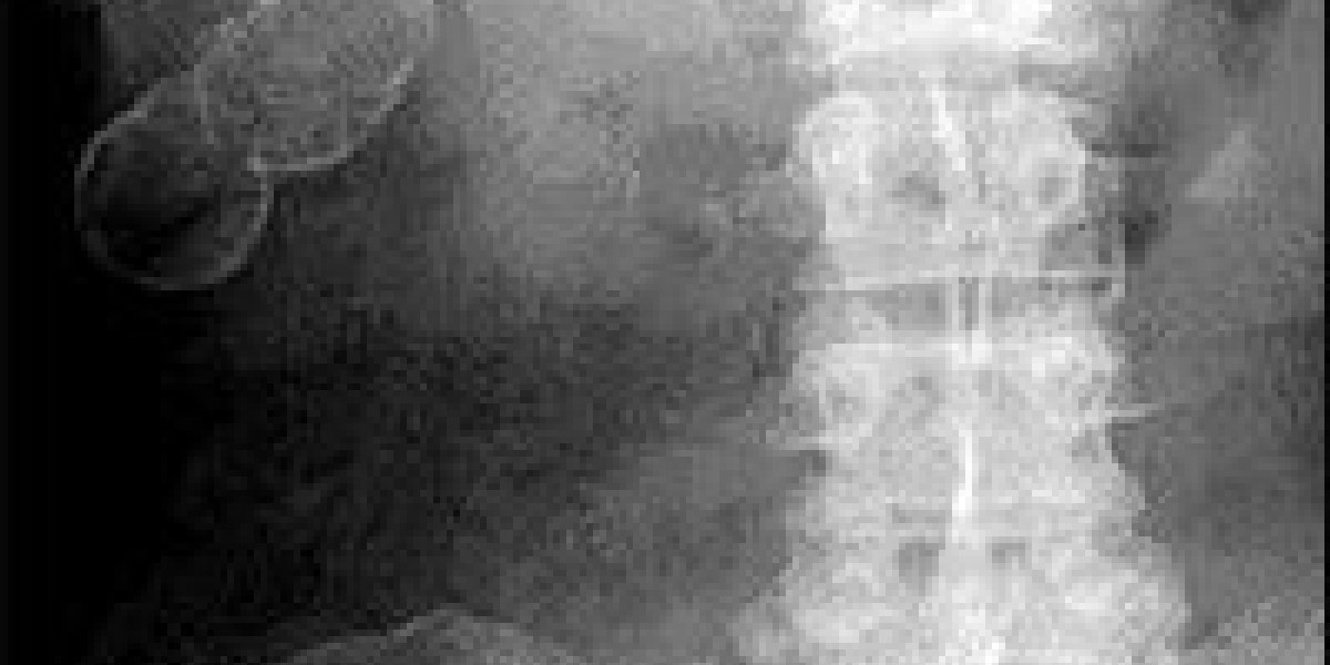 Abdominal Calcifications Review | Dynamic Chiropractic