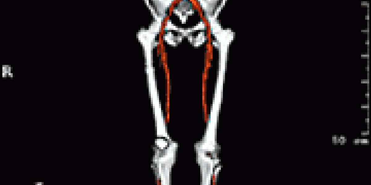Advances in Computerized Tomography (CT) | Dynamic Chiropractic