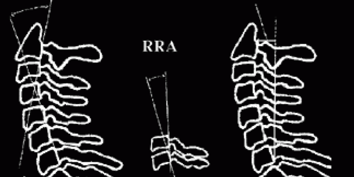 The Forward Head Posture | Dynamic Chiropractic